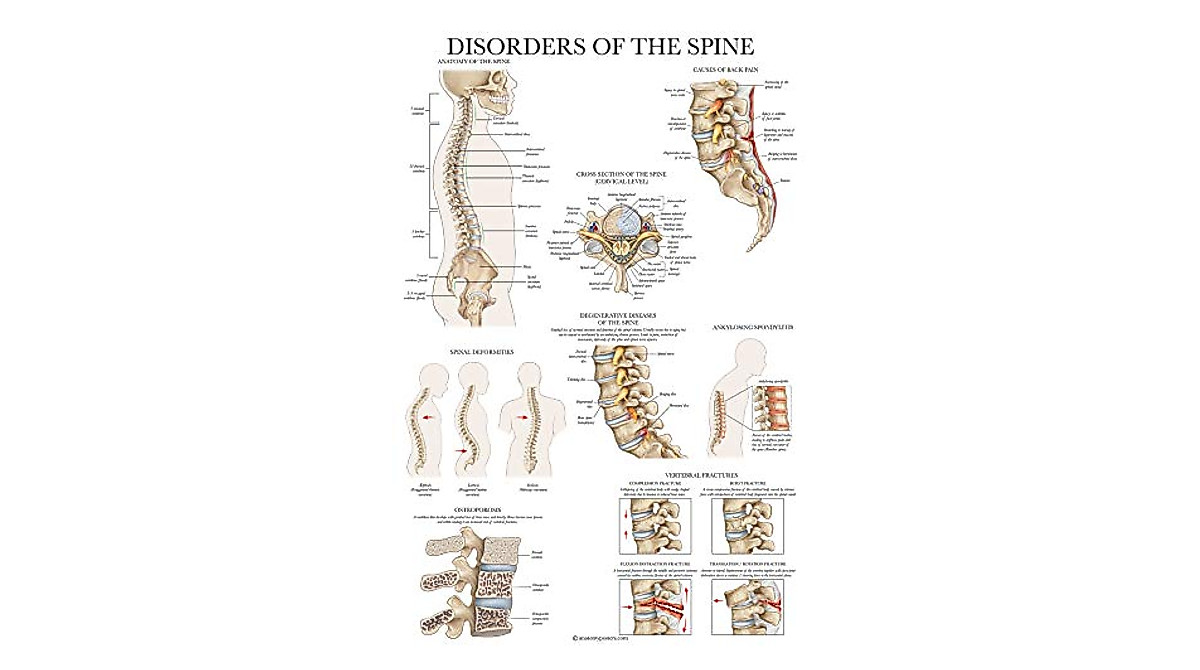 Anatomical Charts: Spinal & Cranial Nerves + Spine Disorders Set