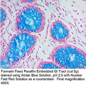 Alcian Blue (pH 2.5) Stain Pack, 1000ml