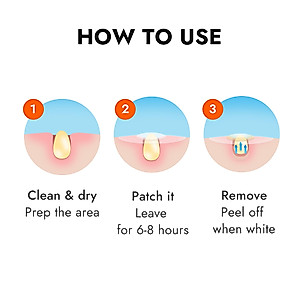 Epielle Over-Zit Acne Variety Patches | 84 Hydrocolloid Acne Pimple Patch for Covering Zits and Blemishes for Full Face (84 Counts), Easter Gift