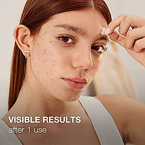 Neutrogena Stubborn Acne Pimple Patches, Acne Treatment for Face, Ultra-Thin Hydrocolloid Spot Stickers Provide Optimal Healing for Pimples, 24 Patches, Pack of 2