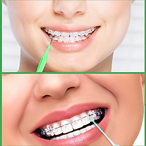 Zopeal 250 Pieces Braces Flossers Interdental Brush for Cleaner Tooth Toothpick Dental Teeth Flossing Head Oral Dental Hygiene Cleaning Tool Soft Dental Picks Refill Toothpick Cleaners (Fresh Color)