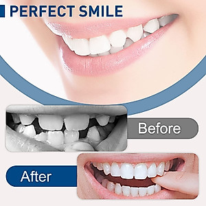 Tooth Repair, Cover The Imperfect Teeth,Fix Your Smile at Home Within Minutes!,Upper and Lower Whitening Teeth Sets2pcs