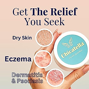 Chicatella Eczema Ointment Cream for Adults and Babies, Extra Strength Anti Itch Moisturizer for Atopic or Seborrheic Dermatitis, Rashes, Dry Skin and Psoriasis (1.85 OZ)