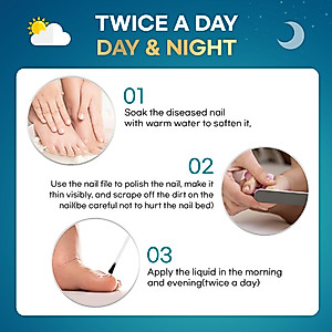 Toenail Fungus Treatment Extra Strength, Nail Fungus Treatment, Nail Fungus Treatment for Toenail & Fingernails, Fungal Nail Treatment for Toenails, Antifungal Nail Treatment for Broken Nail(1oz)