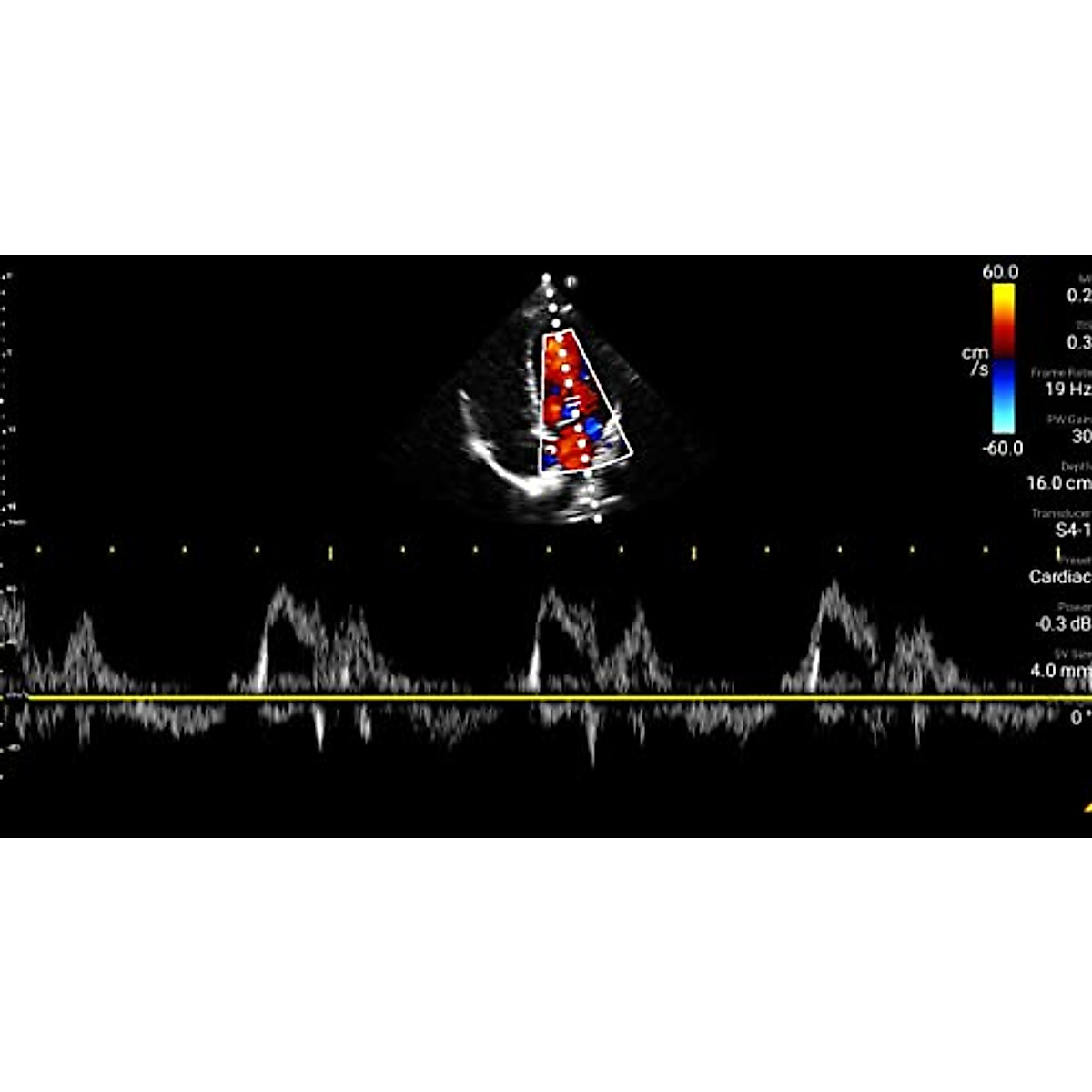 Philips Lumify S4-1 Phased Array Transducer, Portable Ultrasound Solution