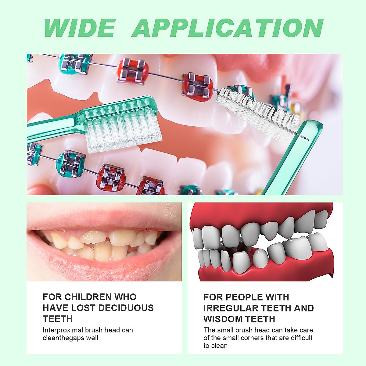 6 Pieces Orthodontic Toothbrush Braces Toothbrush with 6 Pcs Head Protection Cover Double-Ended Interdental Brush V Trim End for Braces Teeth Detail Cleaning 4 Colors