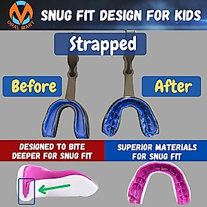 Oral Mart Black/Blue Strapped Youth Mouth Guard for Kids - Sports Mouthguard with Connected Strap for Ice Hockey, Football, Lacrosse, Taekwondo
