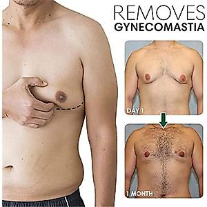 Endxedio SoliPac Gynecomastia Tightening Ginger Cream,Gynecomastia Tightening Ginger Cream,Effectively Shrinks Men Chest Tightening Ginger Cream,Effective Remove Excess Fat (3pcs)