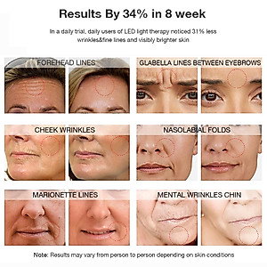 NEWKEY Red Light Therapy Mask for Face Wrinkles, 7 LED Light Therapy Facial Skin Care Mask,At-Home Photon Skin Care Beauty Mask for Anti-Ageing