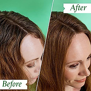 PHILIP KINGSLEY Flaky Scalp Shampoo for Flaky Dry, Oily Scalps Cleansing Scalp Care Hair Products Soothing, Soothes and Calms, 8.45 oz.