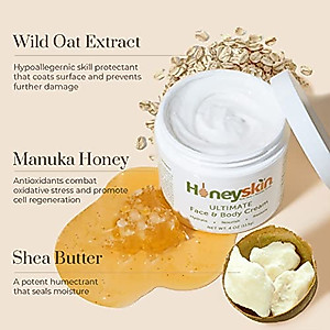 Hydrating Face Moisturizer for Women and Men with Manuka Honey and Coconut Oil - Face Cream and Body Lotion for Dry Skin, Eczema Cream, Psoriasis Cream - Rosacea Treatment for Face - Made In USA (8oz)