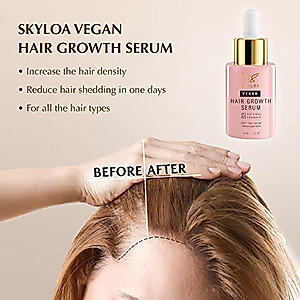 Skyloa Hair Growth Serum, Vegan Hair Serum, Hair Growth Oil For Women, Hair Serum For Hair Growth Scalp Serum, Hair Regrowth Treatment For Women Fuller-Looking, Thicker And Healthier 30ml