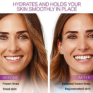 Furlesse Elevens Wrinkle Patches, Overnight Wrinkle Patches for Frown Lines, Non-Invasive Anti-Wrinkle Patches, Anti-Aging Skincare, 30 Patches, 30-Day Use