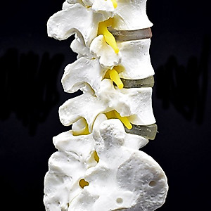 Medical Human Lumbar Spine Demonstration Model Anatomical Model Lumbar Vertebrae Sacrum & Coccyx, with Herniation Disc,for Science Classroom Study Display Teaching Medical Model 15 Inch Hight
