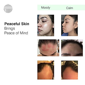 Dermazen Calming Seborrheic Serum, Dermatologist Recommended, Topical Serum For Hair, Face, and Body (4oz)