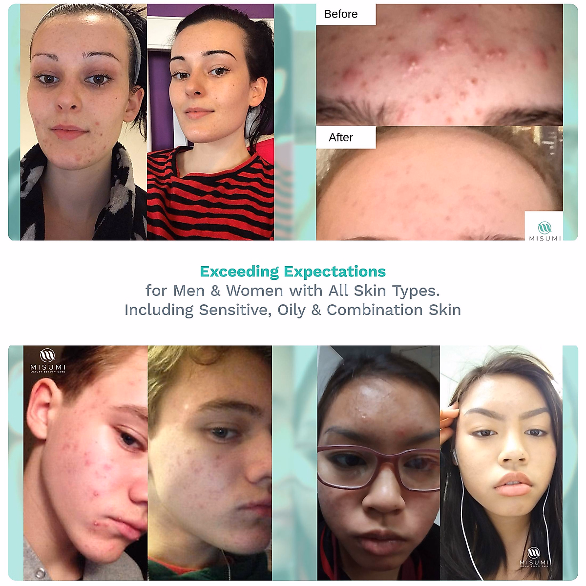 AHA Glycolic Acid 10% Acne Face Wash to Help Clear Clogged Pores - Anti-Aging Acne Skincare Glycolic Acid Face Wash with Natural Ingredients - Acne Cleanser Glycolic Face Wash - Acne Control Cleanser