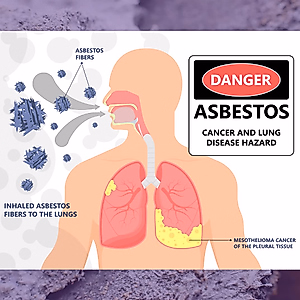 PRO-LAB Asbestos Test Kit - (2 Samples) Emailed Results Within 3 to 5 Business Days - Includes Return Mailer and Expert Consultation. Optional Lab Fee for NVLAP Analysis
