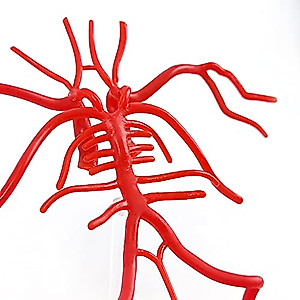 Evotech Brain Artery Model, Life Size Intracranial Artery Model, Shows Internal Carotid Artery, Willis Circle and Basillary Artery & Their Branches. On a Plexiglass Base