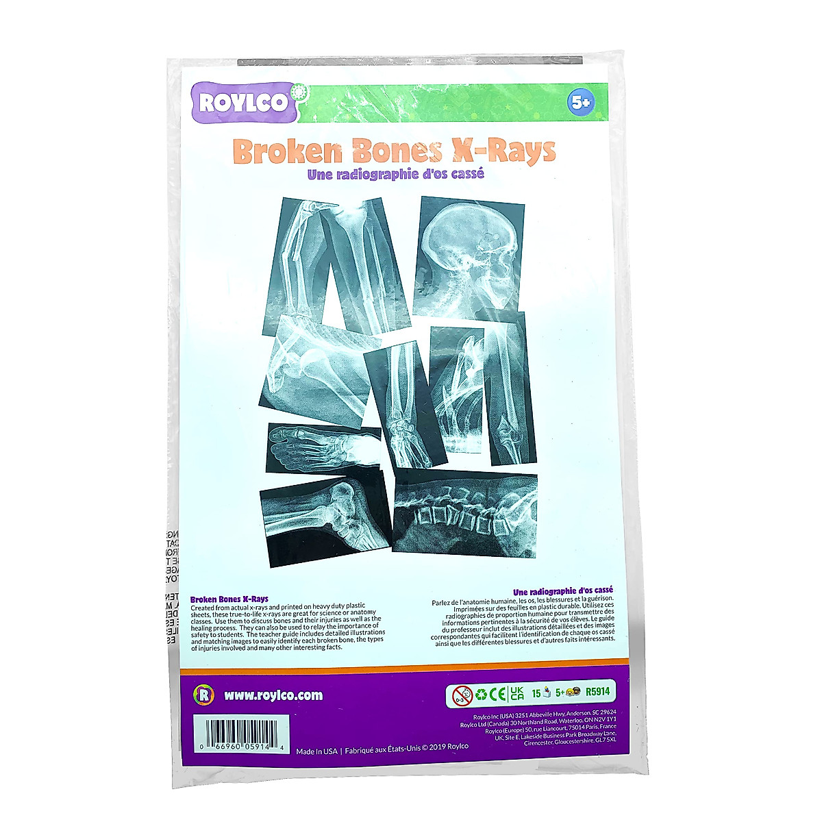 Roylco Broken Bones X-Rays – 15 Realistic Fracture Images for STEM/STEAM Learning, Classroom Anatomy, Health Education, and Labs – Perfect for Teachers, Parents, and Medical Training