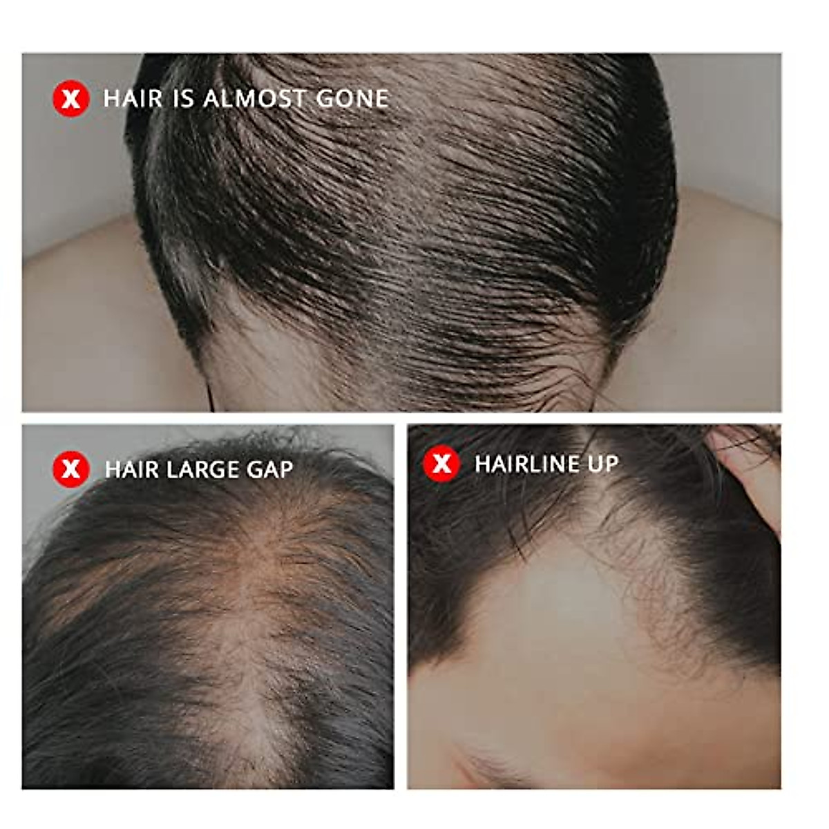 Korean Face Roller Hair Spray Hair Growth Oil Hair Growth Thicker Fuller Healthier Hair Hair Loss And Thinning Women And Men 30ml for Skin Care