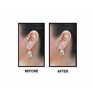 Lobe Miracle Support Patches for Earrings 60 ea (Pack of 4)
