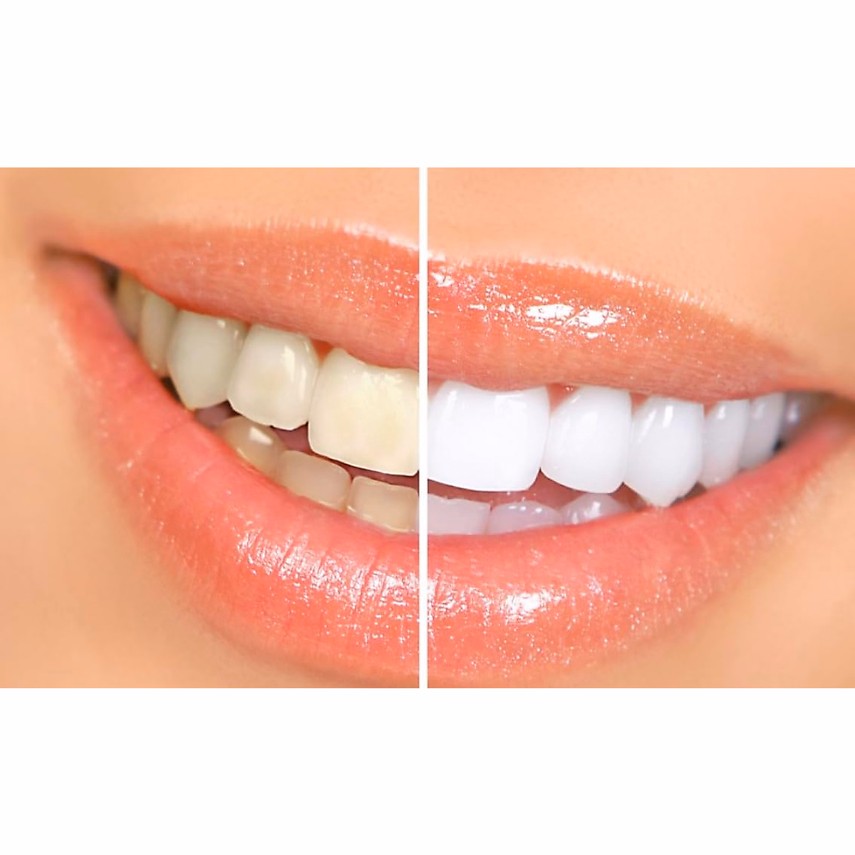 Pepsodent Complete Care Toothpaste Original Flavor 5.5 oz (Pack of 24)