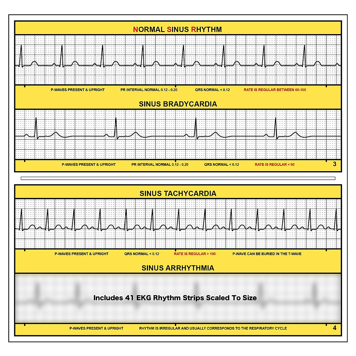 R-CAT for Arrhythmias EKG Pocket Reference Guide – Great Study Card for EKG Interpretation - ACLS and PALS Training – Cardiac Rhythm Interpretation Made Easy