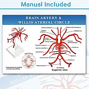 Evotech Brain Artery Model, Life Size Intracranial Artery Model, Shows Internal Carotid Artery, Willis Circle and Basillary Artery & Their Branches. On a Plexiglass Base