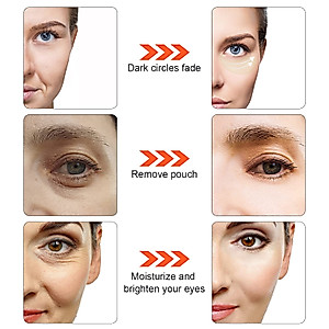 2PCS Verfons Firming Eye Cream,Verfons Snake Venom Firming Eye Cream, Verfons Temporary Firming Eye Cream for Bags, Anti Aging Eye Bag Cream, Instant Remove Eye Bags Fades Fine Lines and Wrinkles