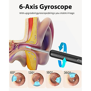 BEBIRD R1 Ear Wax Removal Tool - Spade Ear Cleaner with Ear Camera, 1080P Ear Scope, Earwax Remover Picker with 10 Replacement Tips Ear Pick with 6 LED Light for Earwax Cleaning, Support iPhone, Black