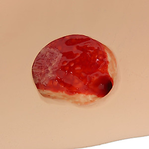 Seymour II" Wound Care Model, Light