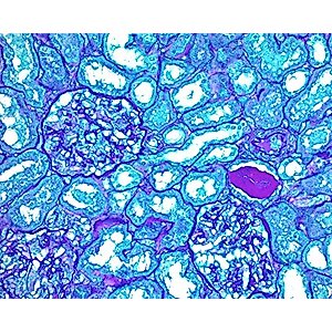 Periodic Acid Schiff (PAS) Stain Pack, 500ml