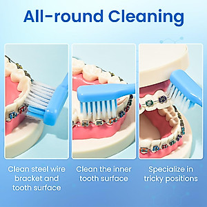 Y-Kelin V-Shaped Orthodontic Toothbrush for Braces Brackets 4 Count (Pack of 1) Soft Bristle with Inter Dental Brush