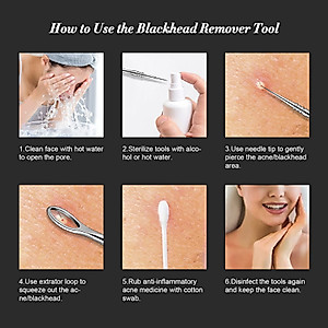 BEZOX Acne Needle Blackhead Remover Tools, Set of 3 Surgical Grade Stainless Steel Pimple Popper Facial Tools with Metal Storage Case