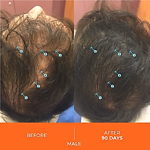 DS Laboratories Revita Tablets, Hair Supplement for Hair Growth Support, Zinc, Iron, Magnesium, Melatonin, Vitamin D & Biotin Vitamins for Women & Men, Hair Vitamins for Thicker Hair Growth, Hair Care