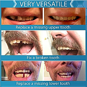 Instant Smile Complete Your Smile Temporary Tooth Replacement Kit - Replace a Missing Tooth in Minutes - Patented
