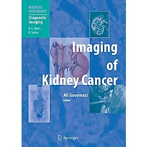 Imaging of Kidney Cancer (Diagnostic Imaging)
