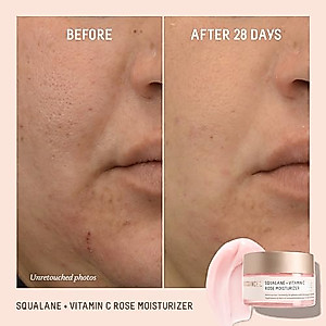 Biossance Squalane + Vitamin C Rose Moisturizer. Antioxidant-Rich Daily Moisturizer to Boost Radiance, Even Skin Tone and Smooth Fine Lines and Wrinkles (1.69 fl oz)