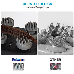 Electric Head Scalp Massager- Rechargeable, IPX7 Waterproof Cordless Scalp Massager w/ 100 Massage Nodes & 5 Speed Modes- for Scalp Stress & Body Pain Relief, Ideal Gifts for Women, Men, Pets (Black)