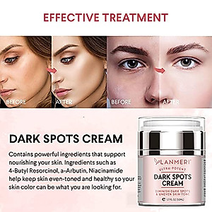Lanmeri Dark Spot Remover for Face and Body, Dark Spot Corrector Fade Cream, Age Spot, Brown Spot, Sun Spot & Freckle Remover for Face, Hands and Other Body Areas, for Both Women and Men, for All Skin Types