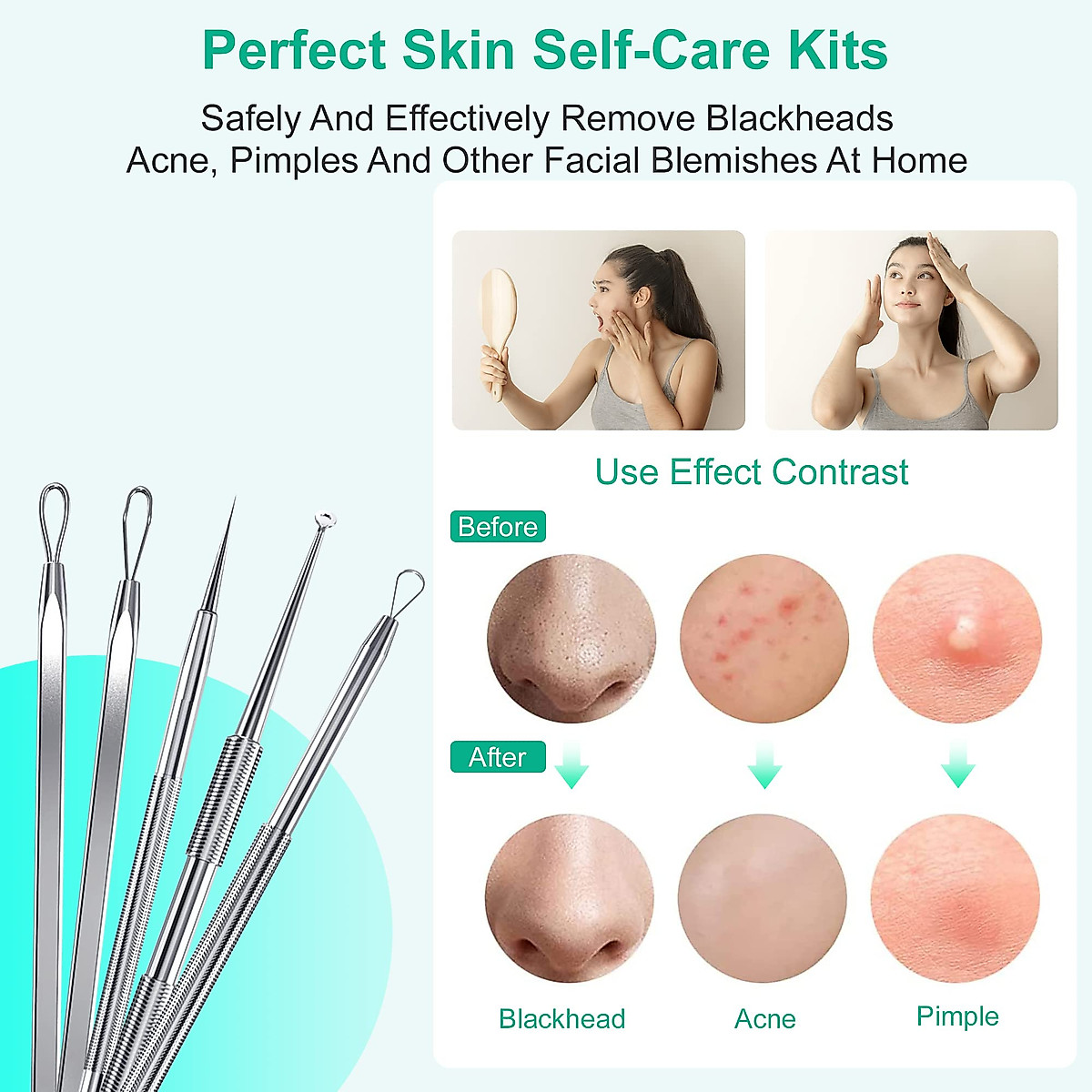 Blackhead Remover Tool,lalasis 5 Pcs Pimple Popper Tool Kit，Blackhead Extractor Tool for Face Comedone Zit Acne Whitehead Blemish Popping Stainless Steel Extraction Tools Set
