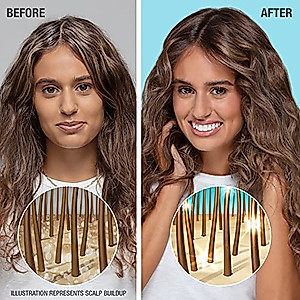 Neutrogena Moisturizing Healthy Scalp Hydro Boost Shampoo & Conditioner for Dry Hair and Scalp, with Hydrating Hyaluronic Acid, pH-Balanced, Paraben & Phthalate-Free, Color-Safe, 12 Fl Oz