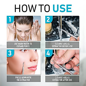 Hula Home Blackhead Remover Pimple Extractor Popper Tool Acne Comedone Blackhead, Blemish, Whitehead Popping, Zit Removing for Nose Face, 304 - Stainless Steel