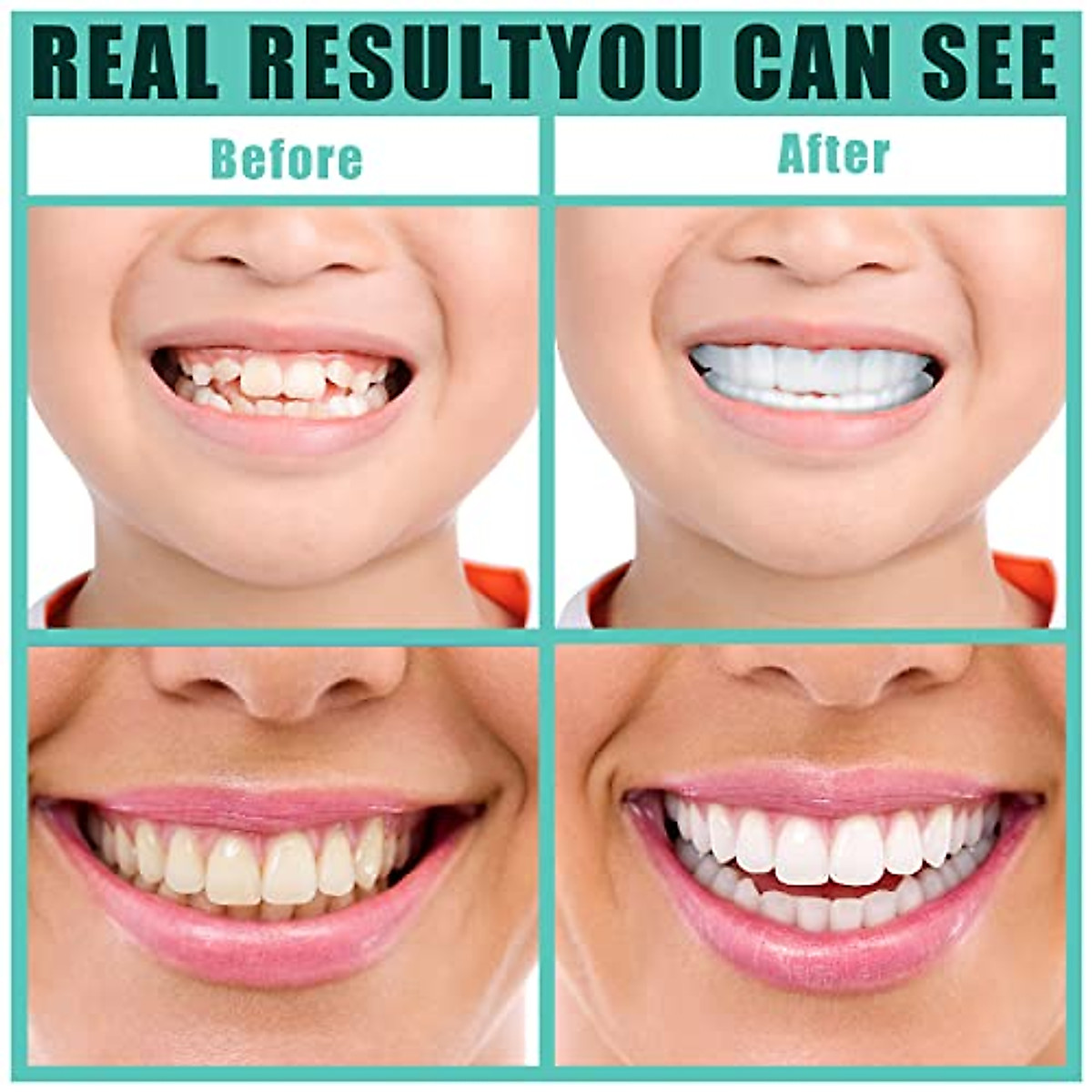 6 Set Fake Teeth Temporary Denture Teeth Veneer Snap in Teeth Confidence Smile Dentures Veneers Fake White Teeth with Mini Tweezers for Men and Women Bad Teeth Whitening Alternative