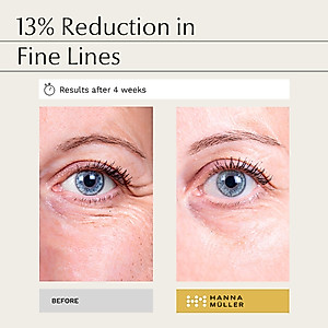 Eye Mask, Under Eye Patches, Gold Eye Patches for Puffy Eyes Reduce Dark Circles, 24k Gold Eye Masks w/Collagen & Snail Peptides, Puffiness, Moisturizing Eye Gel Pads, 30 Pairs, Under Eye Masks