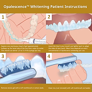 Opalescence 45% Syringes Teeth Whitening Gel - with PF - (4 Syringes) Refill Kit Carbamide Peroxide. Made by Ultradent, in Mint Flavor. Tooth Whitening 5359-2