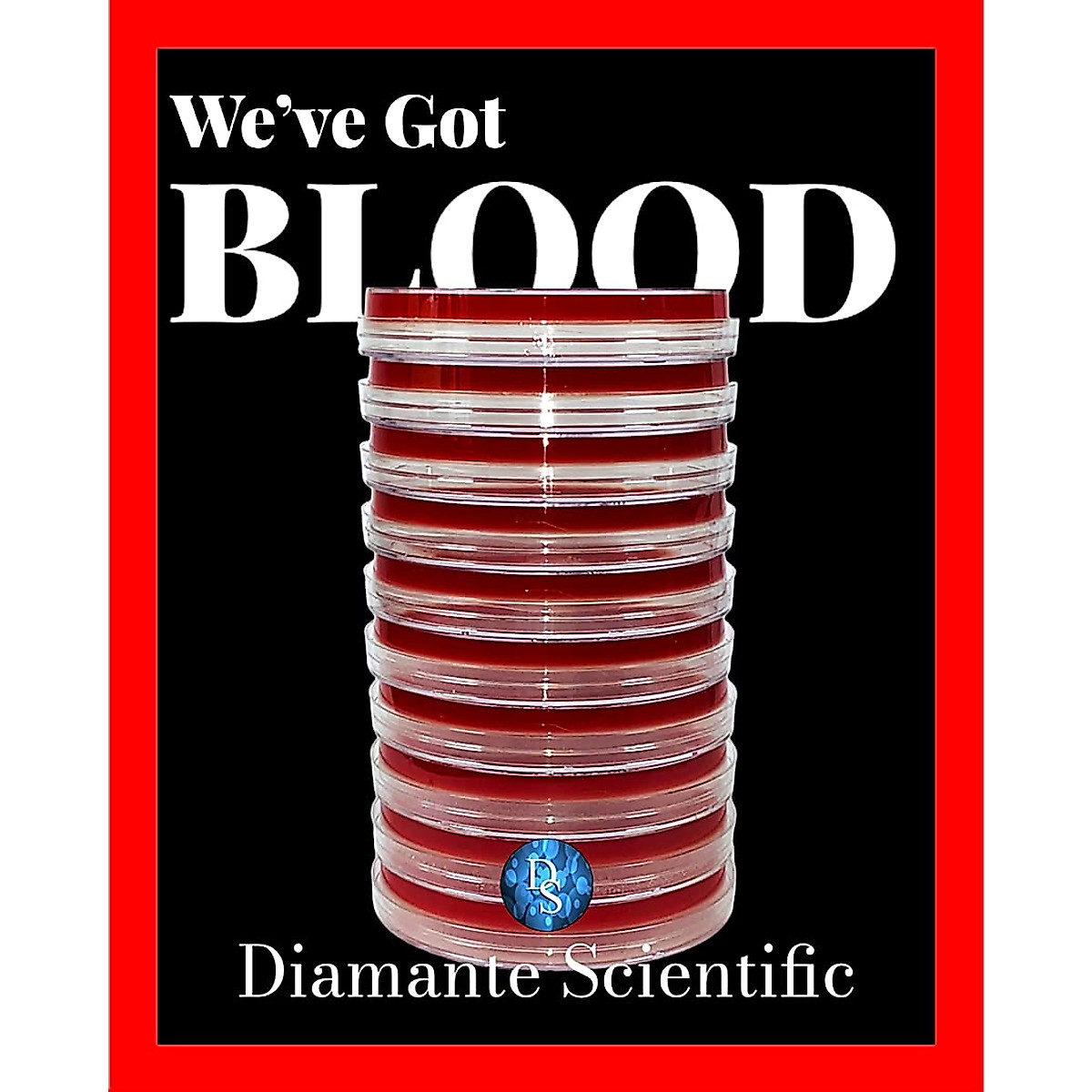 Red Blood Agar (RBA), TSA with 5% Sheep Blood (10-Pack). Pre-Poured, 15x100mm Plates. Used to Detect Hemolysis.