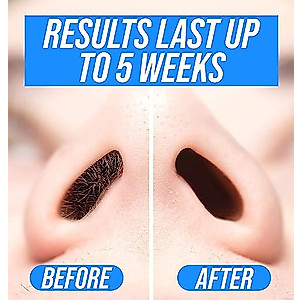 Nose Wax Kit | 100 g Wax, 24 Applicators | The Original and Best Nose and Ear Hair Removal Kit from Kenashii | Nasal Waxing For Men and Women | 12 Applications | 12 Balm Wipes | 12 Mustache Guards