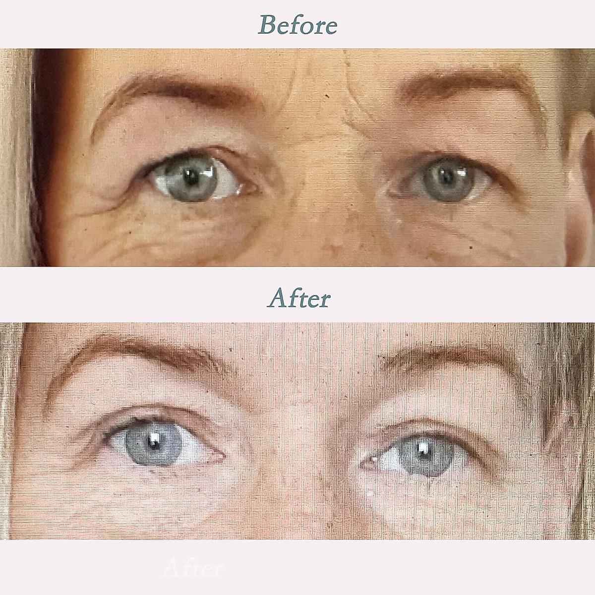 Invisible Double Eyelid Tapes Stickers, Medical-use Fiber Eyelid Lift Strips, Instantly Eye lids Lift Without Surgery, Perfect for Hooded, Droopy, Uneven, Mono-eyelids