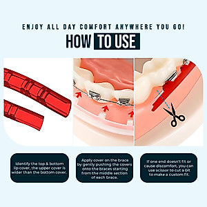 Comfort Cover Braces Guard/Lip and Mouth Protector - Snap on Cover Strip for Braces - Orthodontic/Dental Quality (Red)